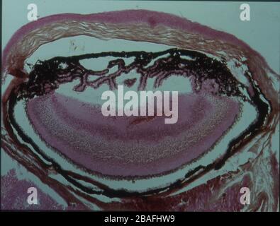 Eyeball in longitudinal section under the microscope 50x Stock Photo ...
