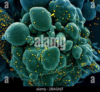 transmission electron microscope image of yellow fever virus Stock ...
