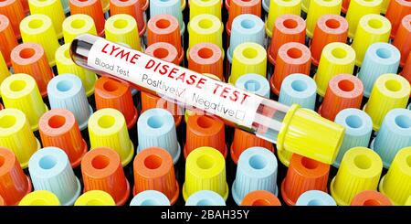 Lyme disease virus - test tubes, blood tests - 3D illustration Stock ...