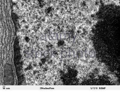 Transmission electron microscope image of pancreatic cells Stock Photo ...