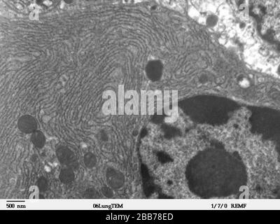 Rough endoplasmic reticulum, TEM Stock Photo - Alamy