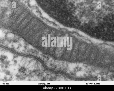 This transmission electron microscope image shows SARS-CoV-2—also known ...