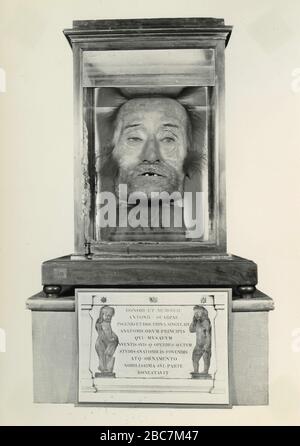 Head of Italian Physician Antonio Scarpa preserved in formalin ...