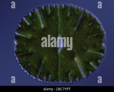 Micrasterias ornamental algae under the microscope 200x Stock Photo - Alamy