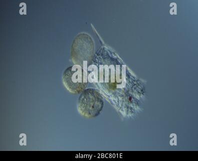Rotifers swim in the water under the microscope Stock Photo - Alamy