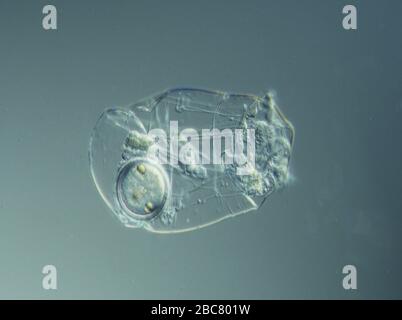 rotifers under the microscope in the water drop 100x Stock Photo - Alamy