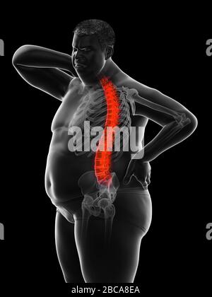 Illustration of an obese man's spine Stock Photo - Alamy