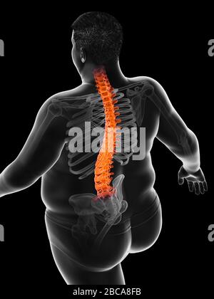 Illustration of an obese man's spine Stock Photo - Alamy