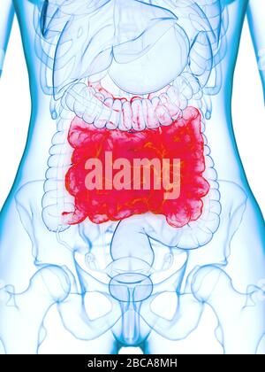 Illustration of an inflamed small intestine Stock Photo - Alamy