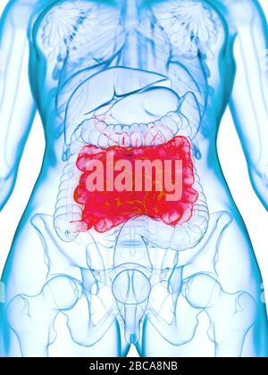 Diseased small intestine, illustration Stock Photo - Alamy