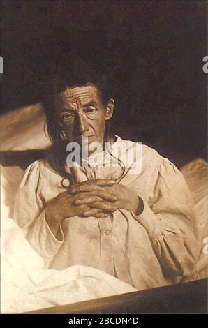 Auguste Deter, First Alzheimer's Patient Stock Photo - Alamy