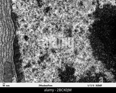 Transmission electron microscope image of pancreatic cells Stock Photo ...