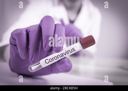 corona virus sample nose covid-19 laboratory test coronavirus covid-19 ...