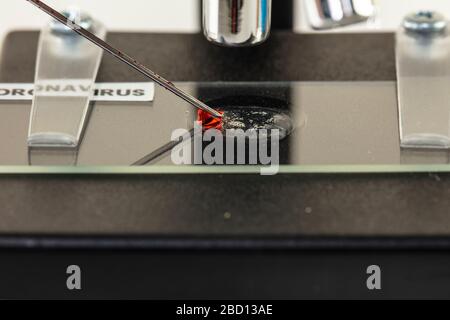 blood sample placed on a microscope slide Stock Photo - Alamy