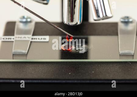 blood sample placed on a microscope slide Stock Photo - Alamy