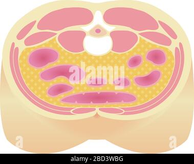 Type of obesity illustration. Abdominal sectional View. (visceral fat ...