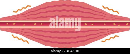 Muscle becomes tense . Flat illustration of muscle and vessel Stock ...