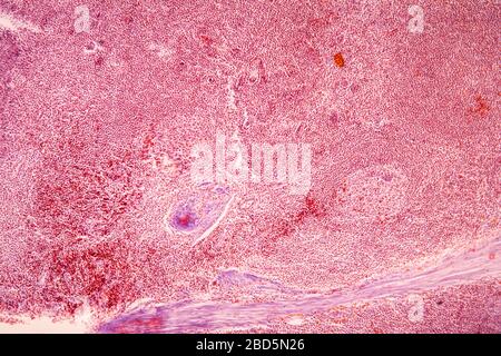 Almond tonsils in cross section under the microscope 100x Stock Photo ...