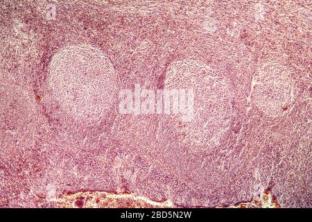 Almond tonsils in cross section under the microscope 100x Stock Photo ...