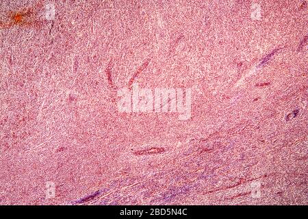 Almond tonsils in cross section under the microscope 100x Stock Photo ...