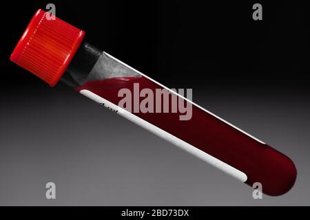 Blood drawing sample test probe collection with blank label tag for ...