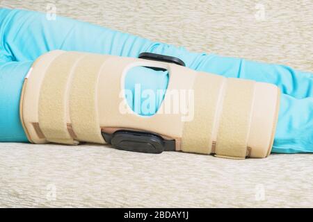 Woman's leg in knee cages for stabilization and support Stock Photo - Alamy