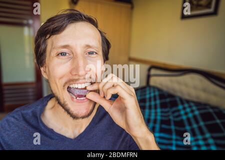 Man placing a bite plate in his mouth to protect his teeth at night ...
