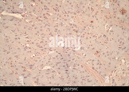 Nerve tissue under the microscope 100x Stock Photo - Alamy