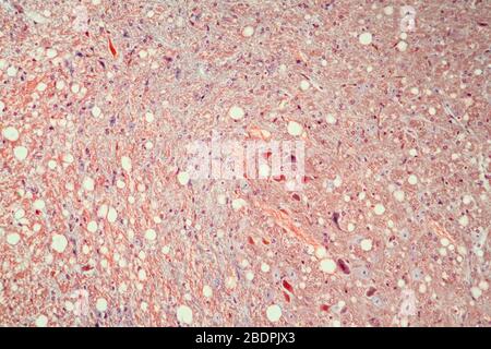 Brain cells tissue under the microscope 100x Stock Photo - Alamy