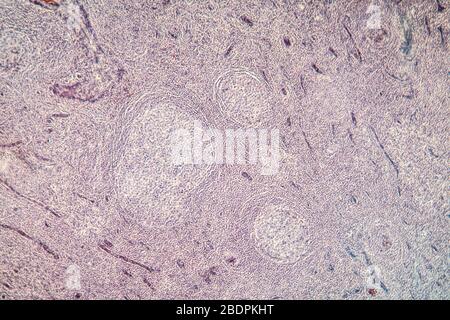 Palatal tonsils transverse 100x under a microscope Stock Photo - Alamy