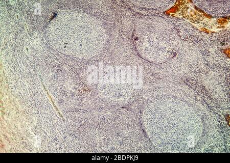 Palatal tonsils transverse 100x under a microscope Stock Photo - Alamy
