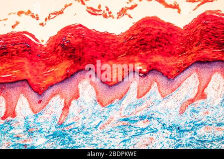 Scar skin tissue under the microscope 100x Stock Photo - Alamy