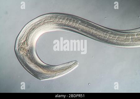 parasitic worm under the microscope 100x Stock Photo - Alamy