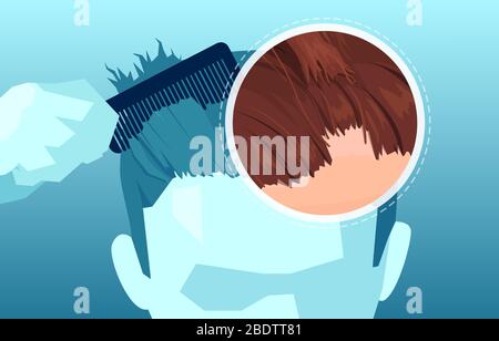 Vector - Hair loss cartoon, Young man and woman serious hair loss ...