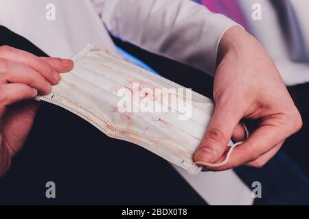 Hemoptysis, coronavirus, protective surgical masks with blood on blue ...