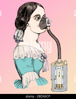History of medicine. Chloroform anesthesia. Engraving, 19th century ...