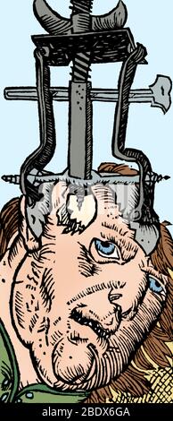Trepanation / trepanning, surgical intervention in which a hole is ...