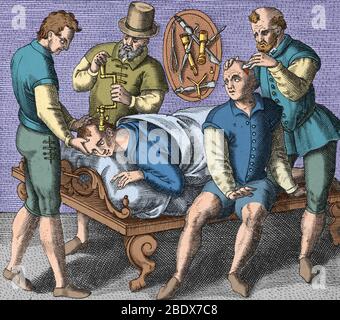 The 16th century illustration of surgery and surgical operations in the ...