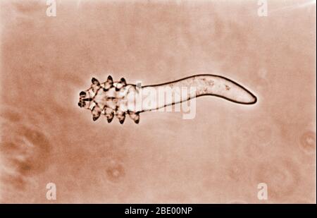 Mite (Demodex folliculorum Stock Photo - Alamy