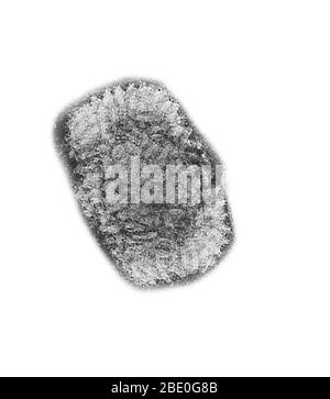 Transmission electron micrograph (TEM) of smallpox virus virions ...