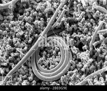 This scanning electron micrograph (SEM) shows us an enlarged view of ...