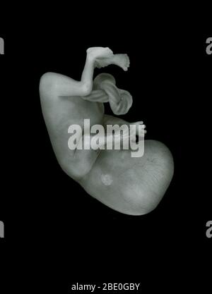 Human embryonic development Stock Photo - Alamy