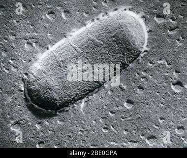 Scanning electron micrograph (SEM) of Bacillus anthracis spore and ...