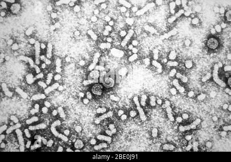 Hepatitis-B Virus, TEM Stock Photo - Alamy