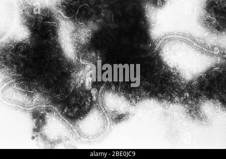 Transmission electron micrograph of human respiratory syncytial virus ...