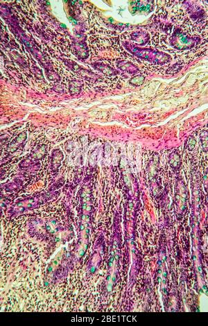 Small intestine pig across 100x Stock Photo - Alamy
