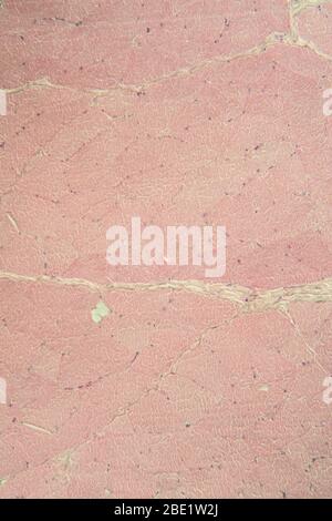Pig skin under the microscope 100x Stock Photo - Alamy