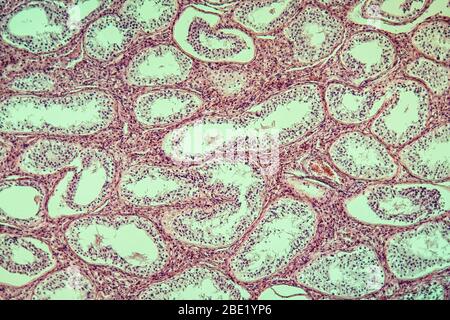 Inguinal testicles gonadically diseased tissue 100x Stock Photo - Alamy