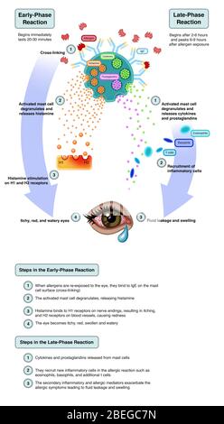 Mast cell releasing histamine, illustration Stock Photo - Alamy