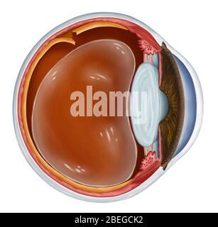 Detached Retina, 2D Illustration Stock Photo - Alamy